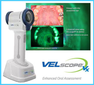 VELscope Oral Cancer Screening | Tewksbury Dental Associates