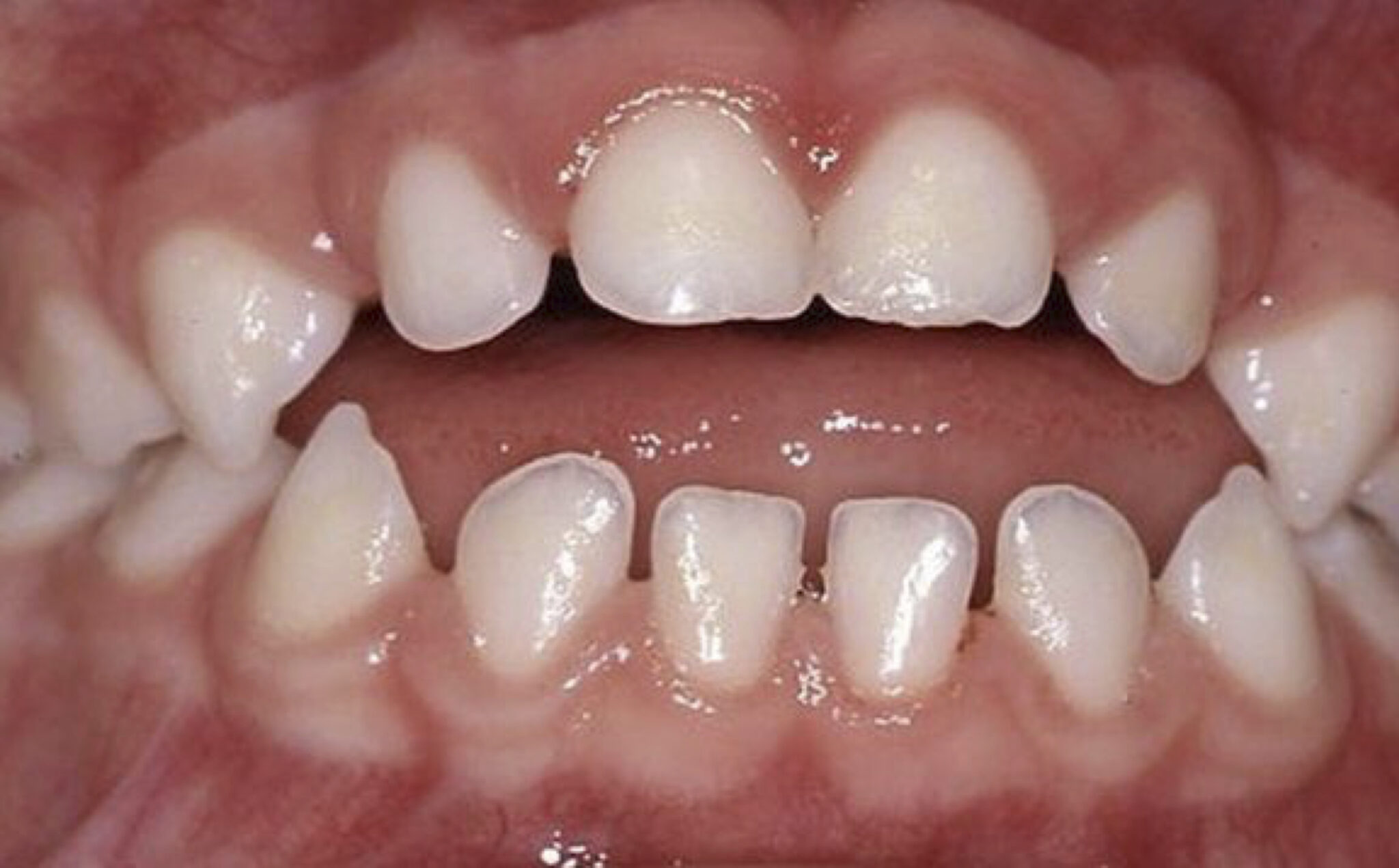 Pediatric Airway and Developmental Dental Therapy for Children at TDA ...